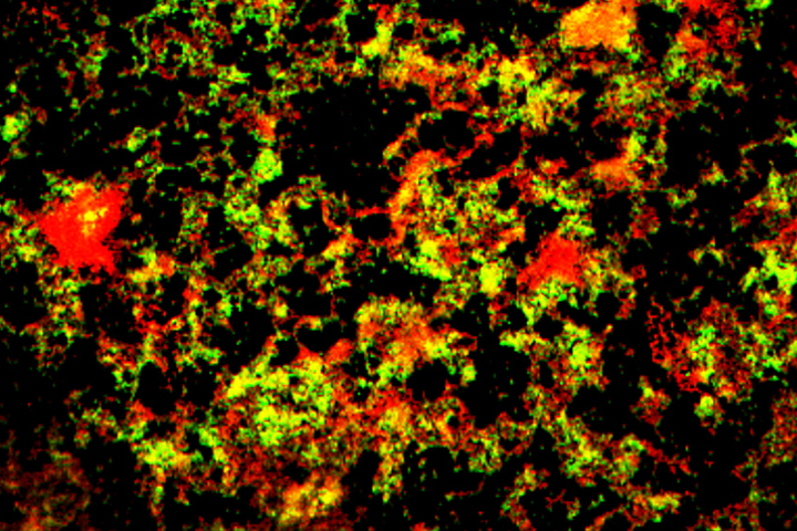 Investigating Biofilms and Antibiotic Resistance in Water | Graham ...